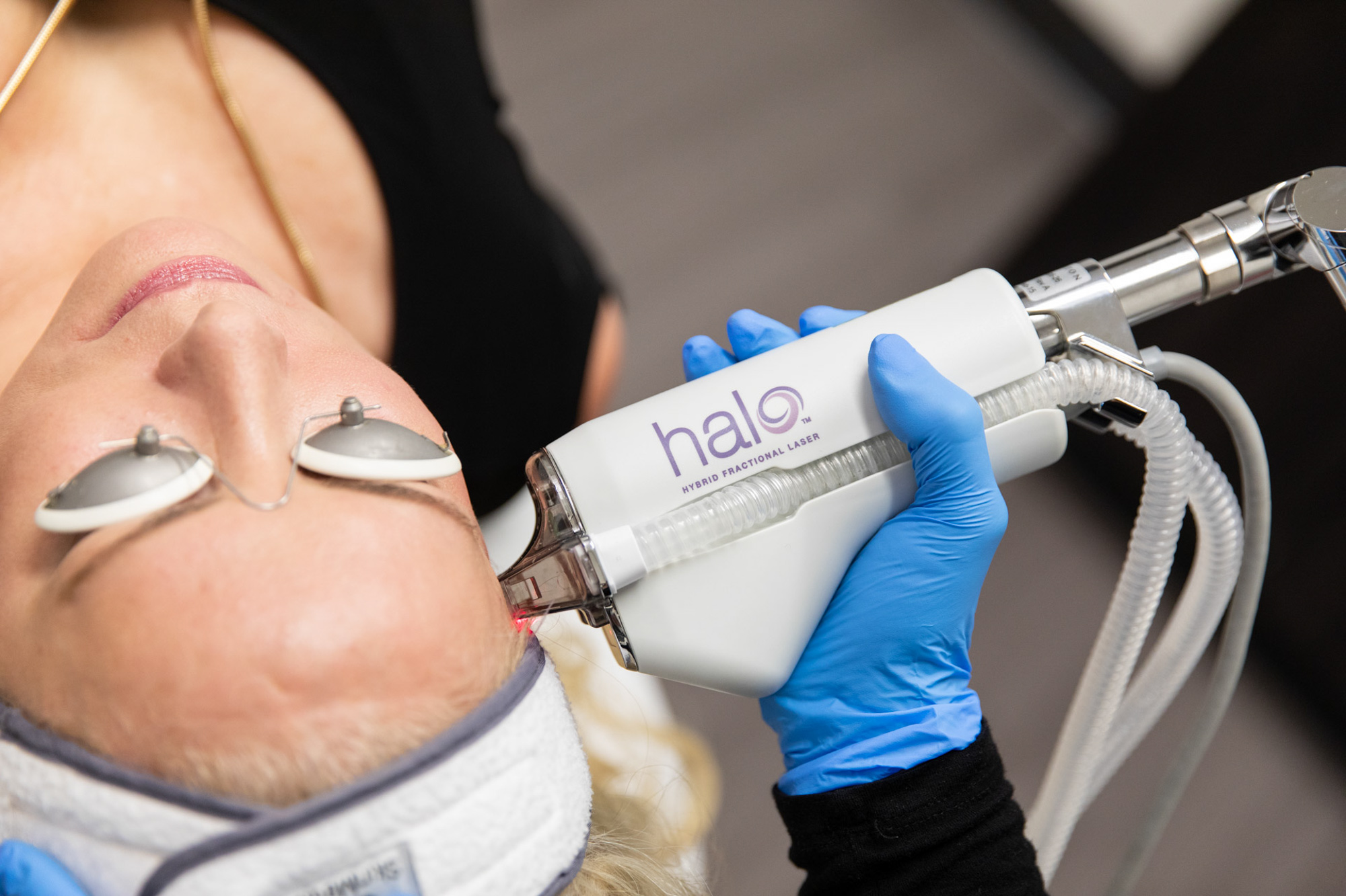 Halo Laser in Winchester | Blossom Medical