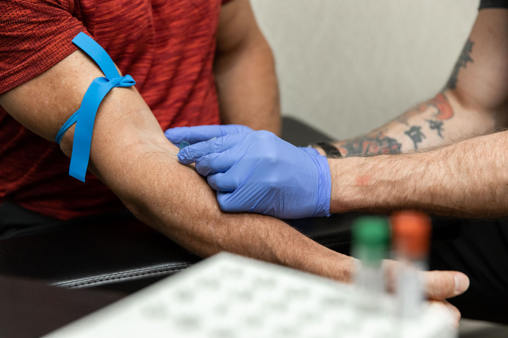 PRP Facial - Blossom Medical