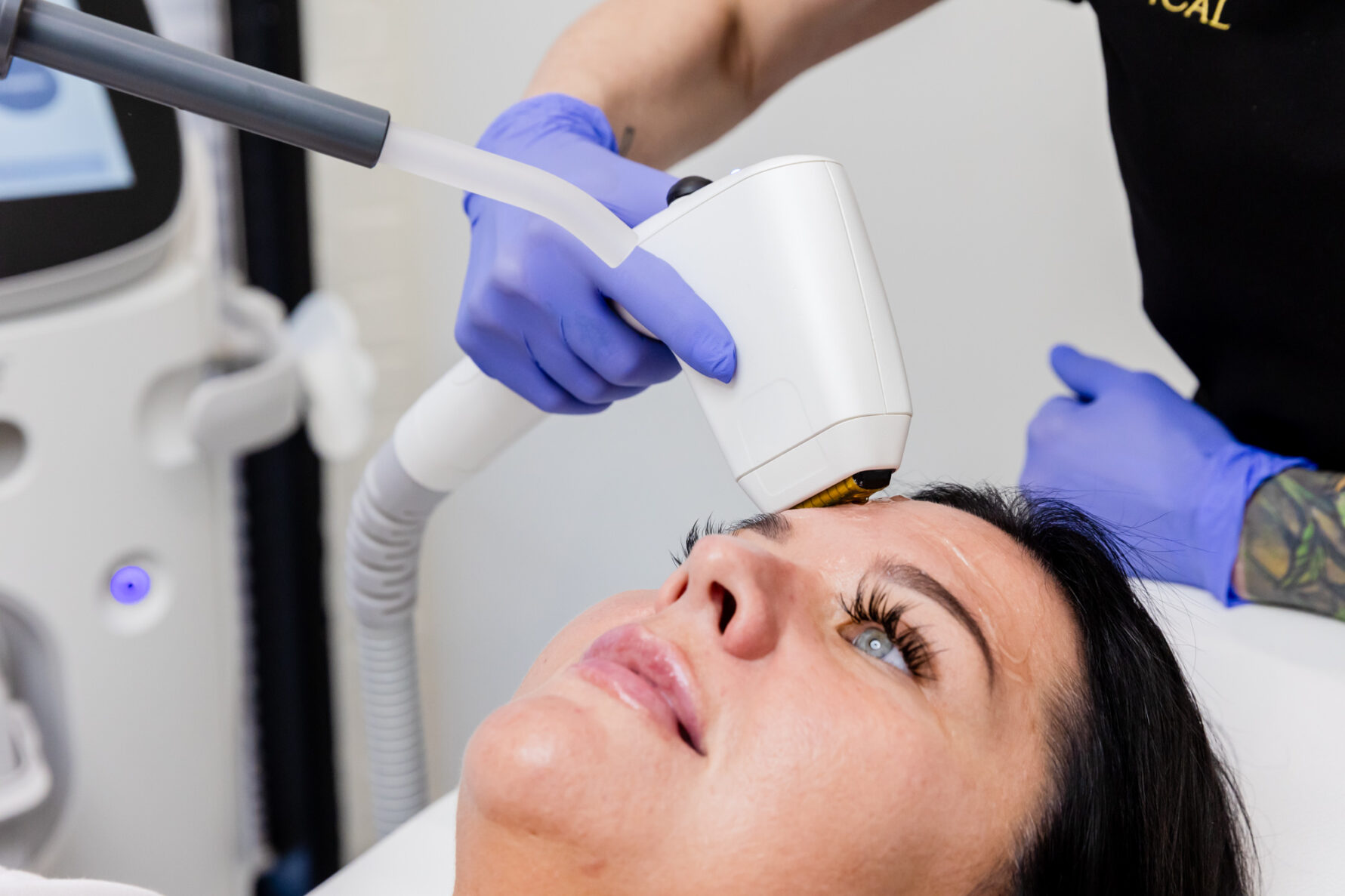 Sofwave | Blossom Medical