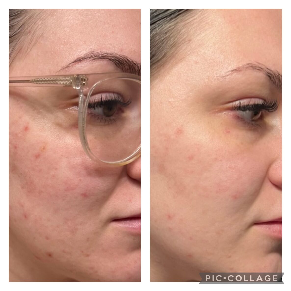 Before & After Archive - Blossom Medical